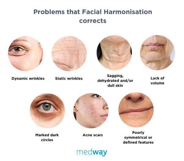 Facial Harmonization - Longevity Clinic Algarve